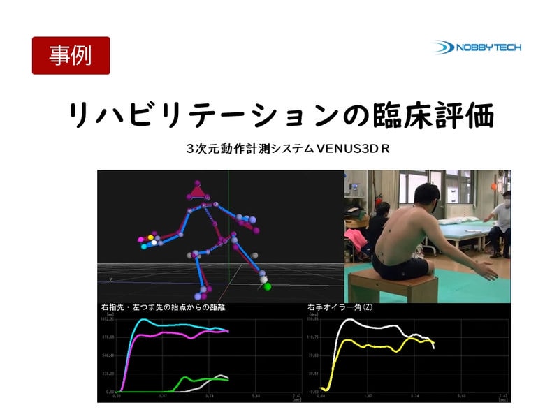 リハビリテーションの臨床評価｜メディア
